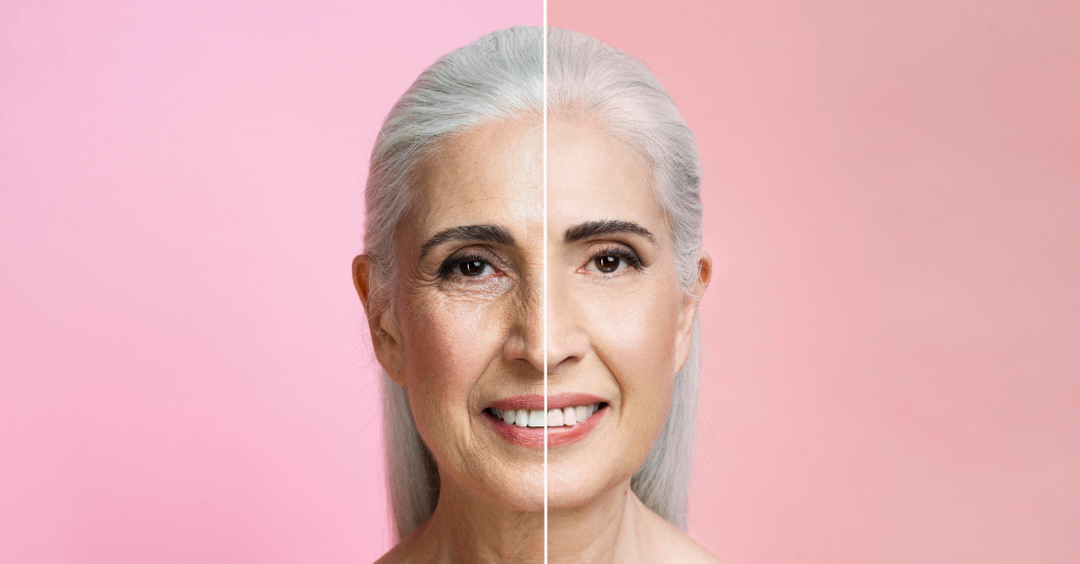 Wrinkles, Pigmentation & Sagging: Skin Aging Explained | Pure Touch Clinic